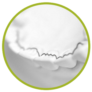 Retainers: Keeping Your Teeth Straight | Sycamore Orthodontics