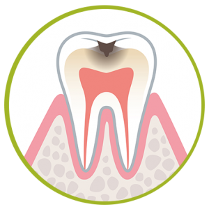 Restorative Treatment - Sycamore Orthodontics & Pediatric Dentistry